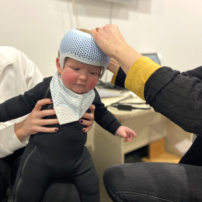 3D Printing and Cranial Remolding Orthosis - OPPAK BLOG